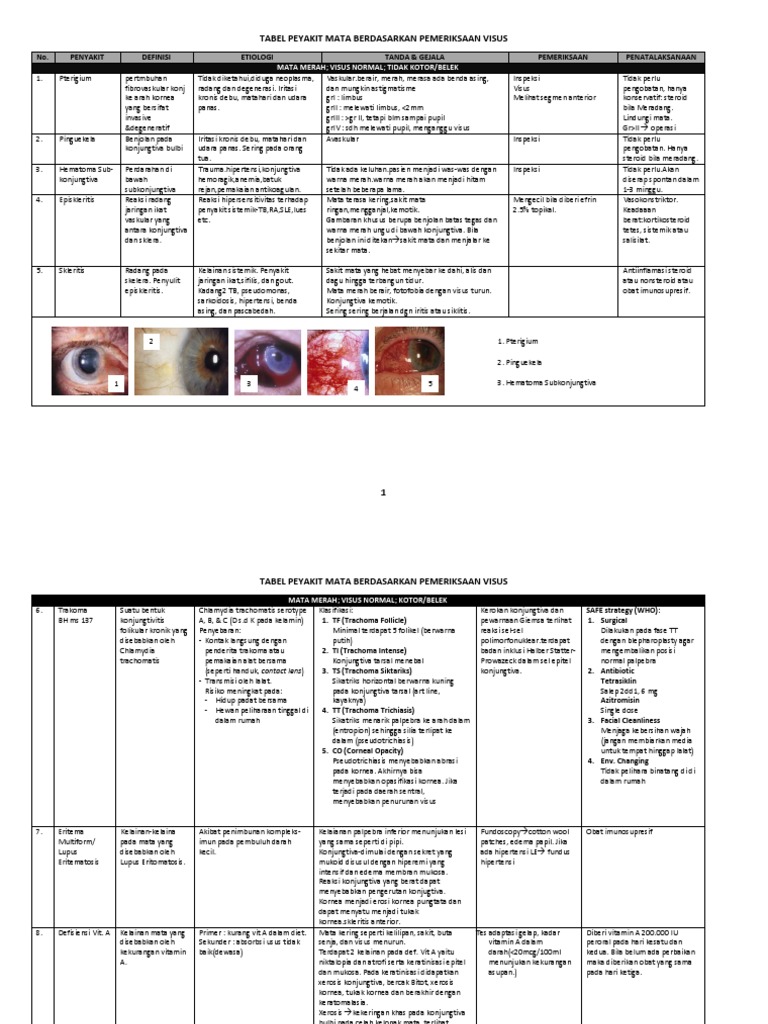 Pemeriksaan Visus Mata | PDF