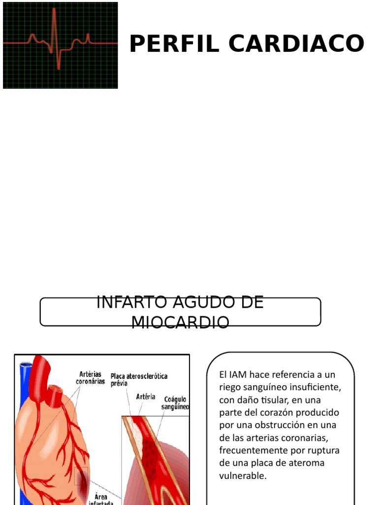 Perfil Cardiaco | PDF | Lactato deshidrogenasa | Transaminasa