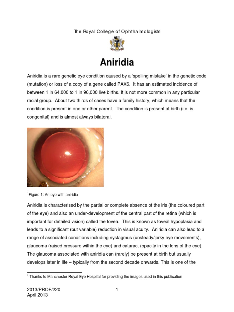 2013 PROF 220 Aniridia | Human Eye | Glaucoma | Free 30-day Trial | Scribd