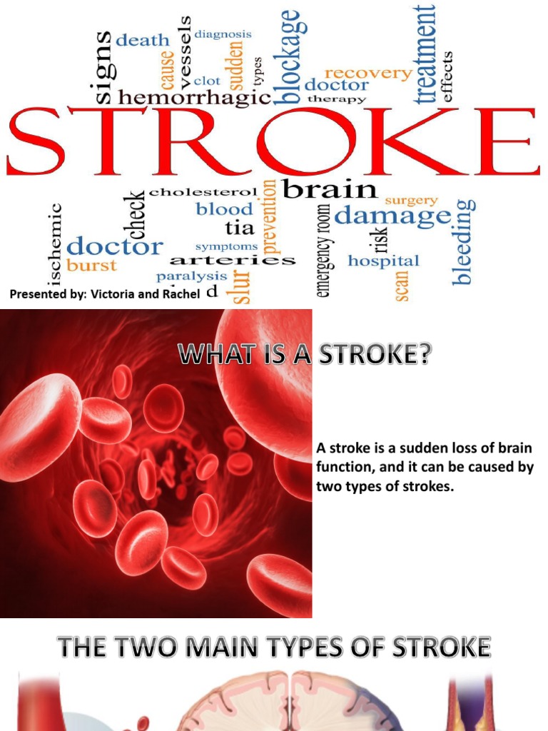 Stroke Presentation | Download Free PDF | Stroke | Ischemia