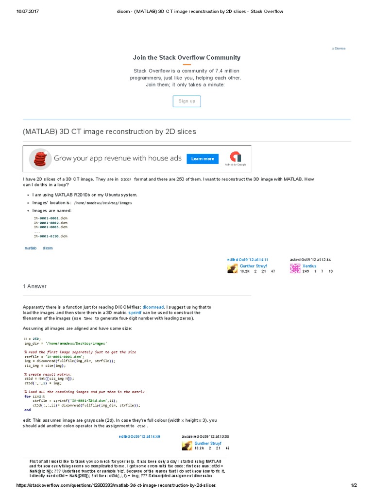Dicom - (MATLAB) 3D CT Image Reconstruction by 2D | PDF | Voxel | Digital Signal Processing
