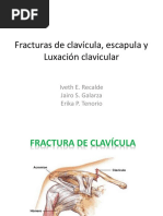 Clasificación de Fracturas de Clavícula Allman | PDF | Historia