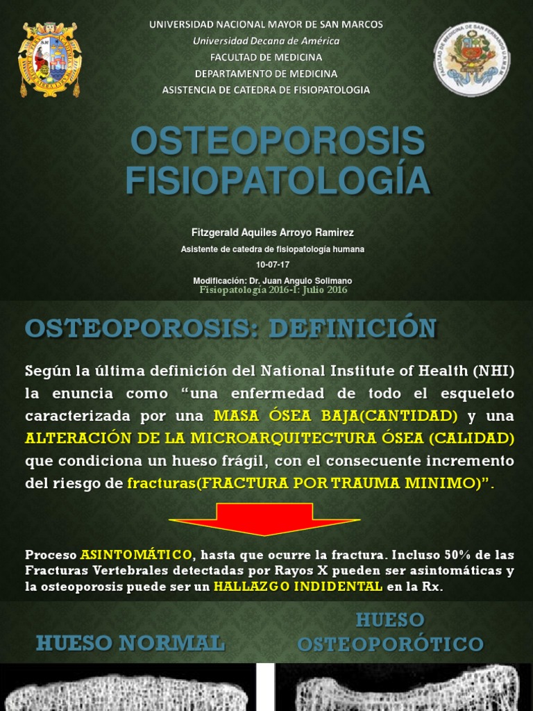 Osteoporosis Fisiopatologia | Osteoporosis | Osteoblastos