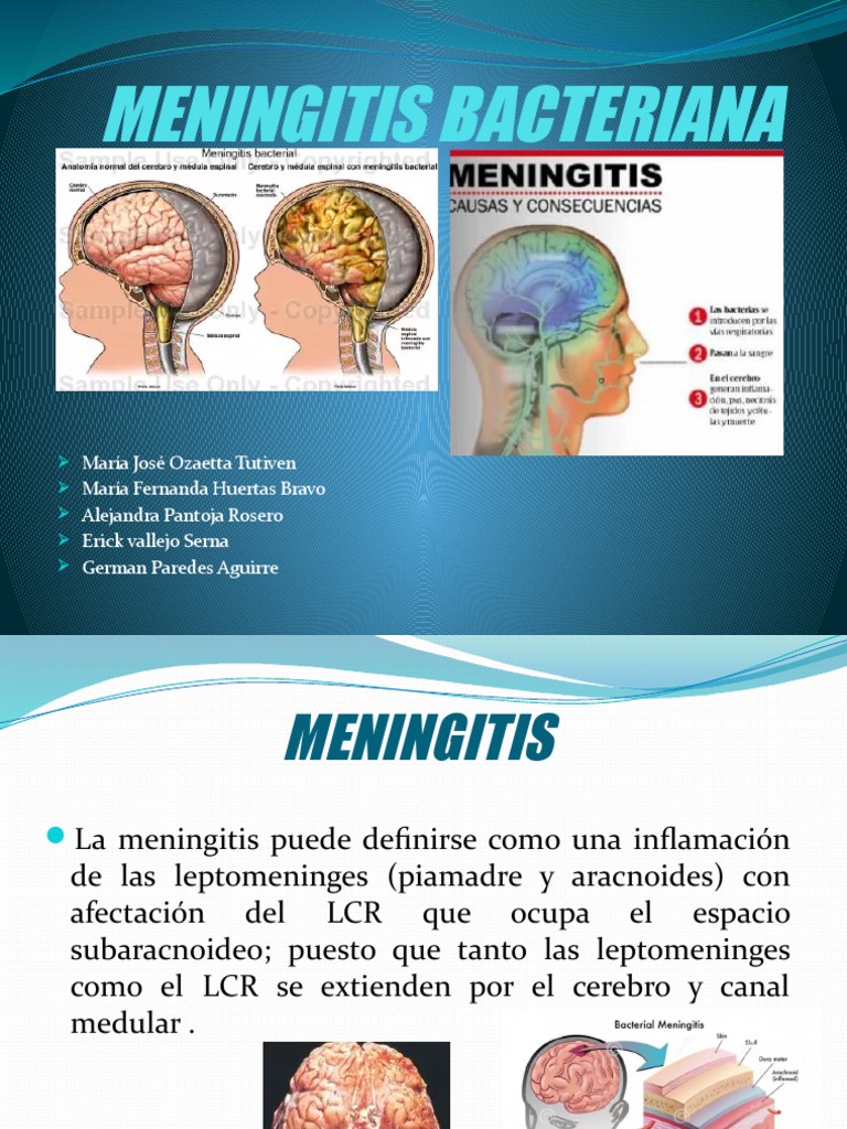 Meningitis Bacteriana | PDF | Meningitis | Epidemiología