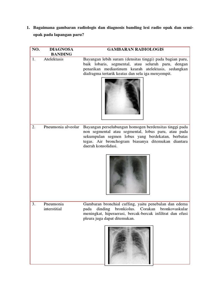 Tugas Radiologi | PDF