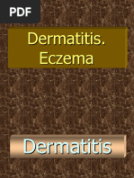 Scabies | PDF | Clinical Medicine | Dermatology