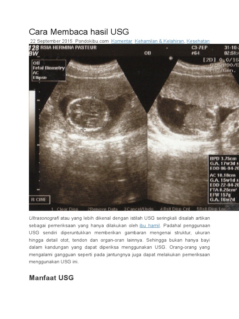 Cara Membaca Hasil USG | PDF