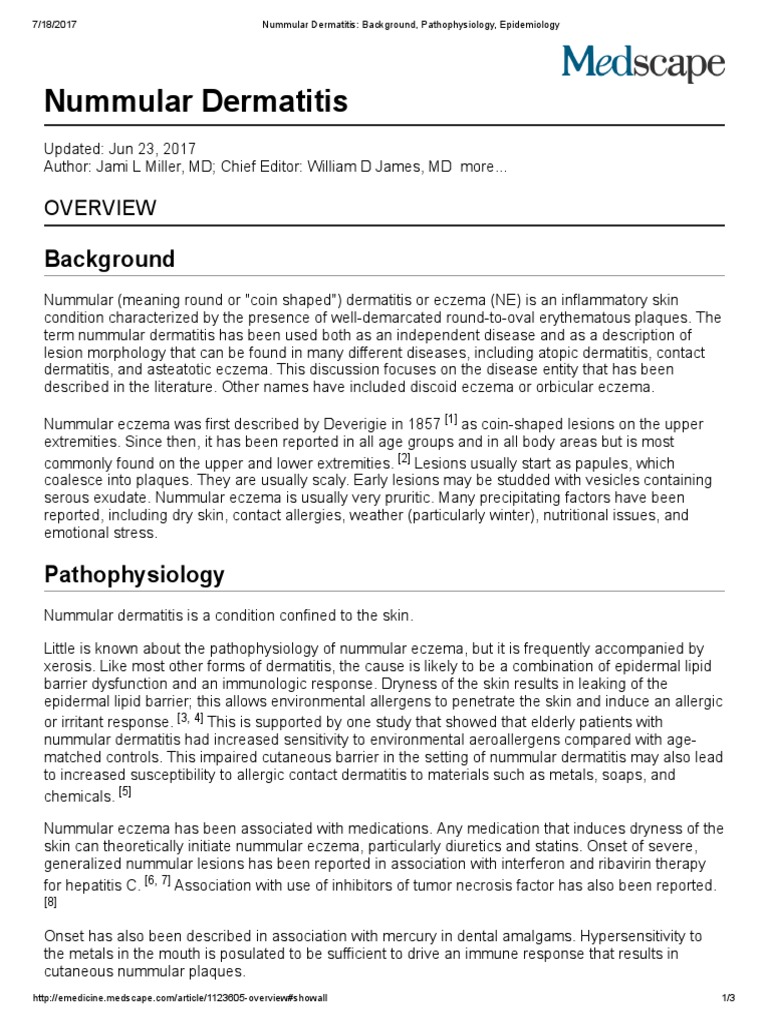 Nummular Dermatitis Overview and Pathophysiology | PDF | Dermatitis ...