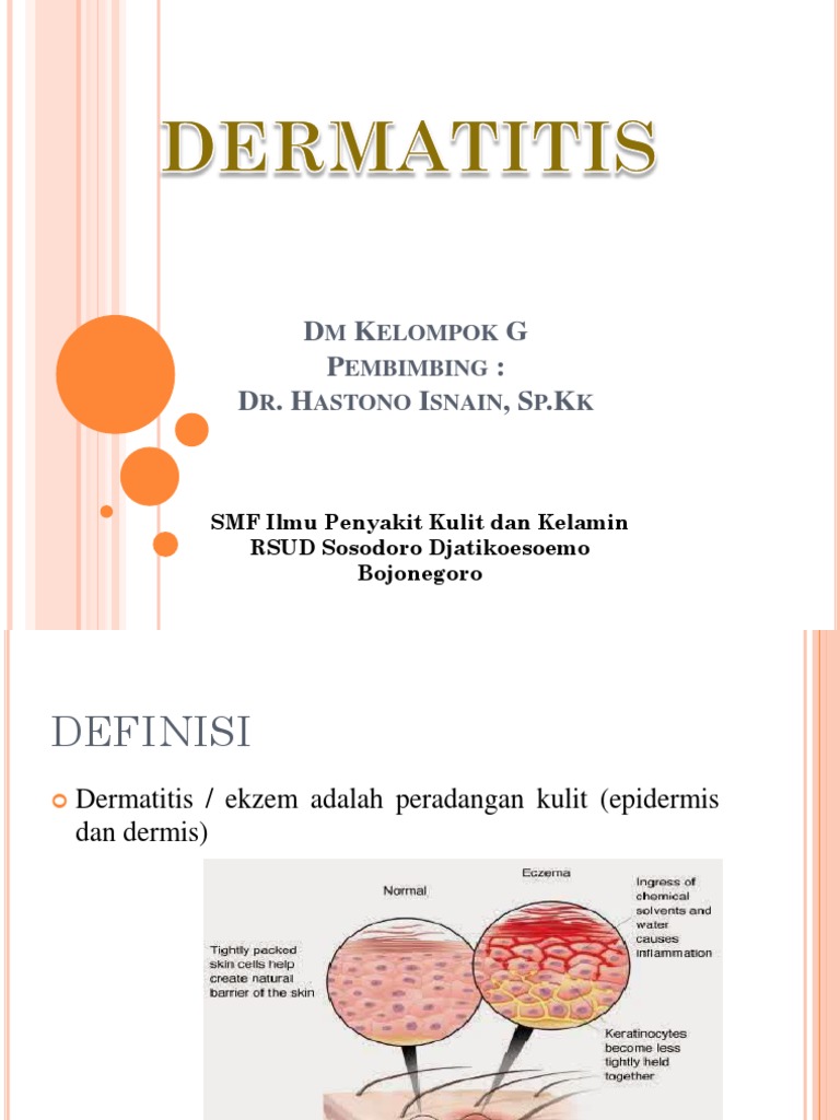 Penanganan dan Jenis Dermatitis | PDF