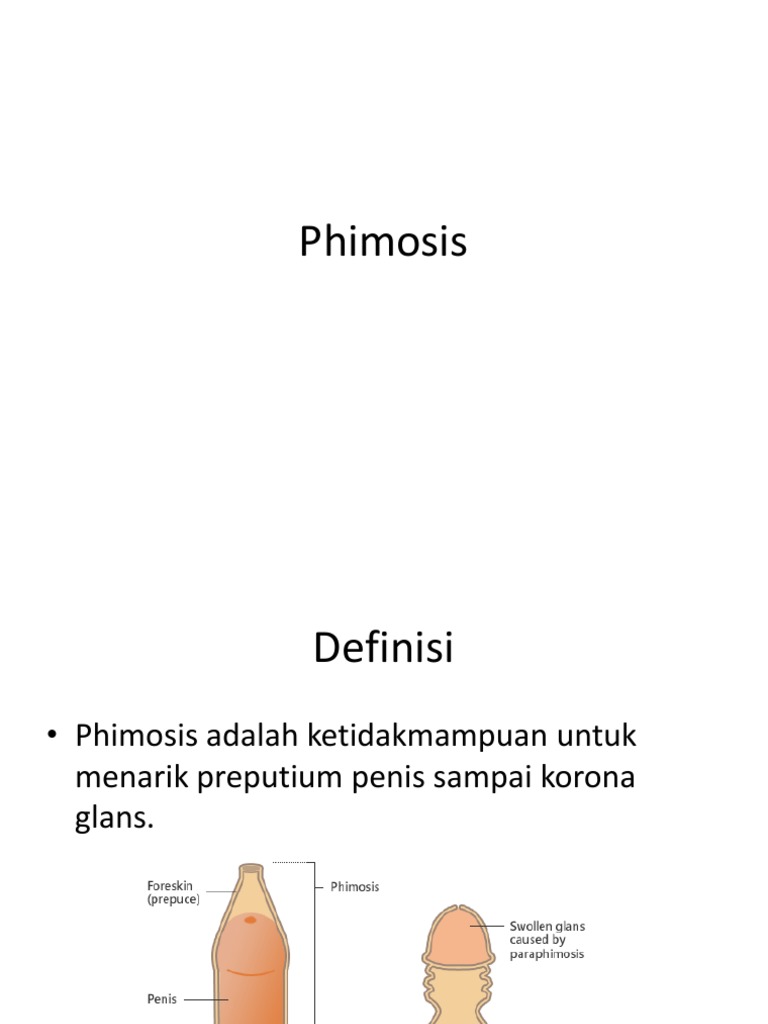 Phimosis