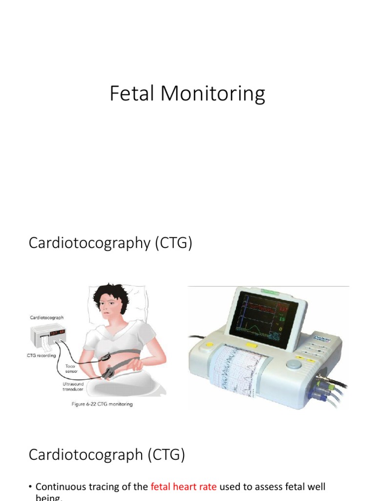 Fetal Monitoring CTG | PDF | Maternal Health | Medicine