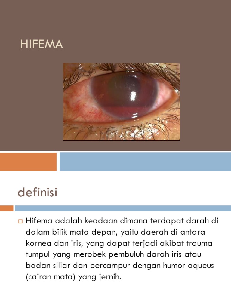HIFEMA | PDF
