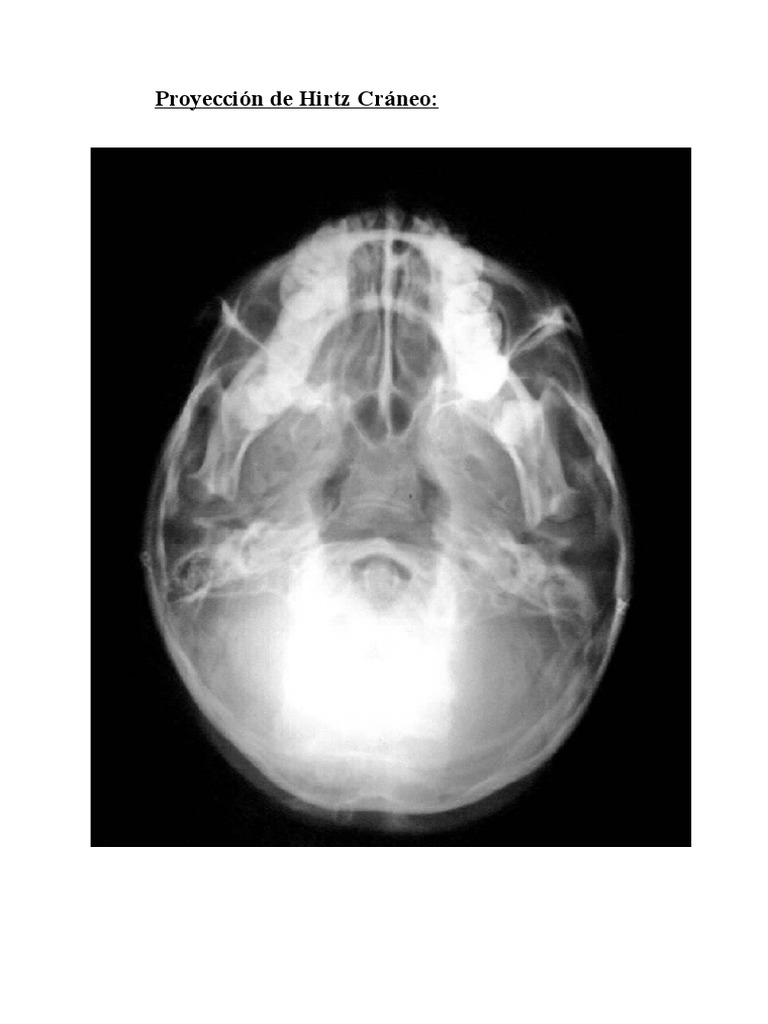 HIRTZ_CRANEO