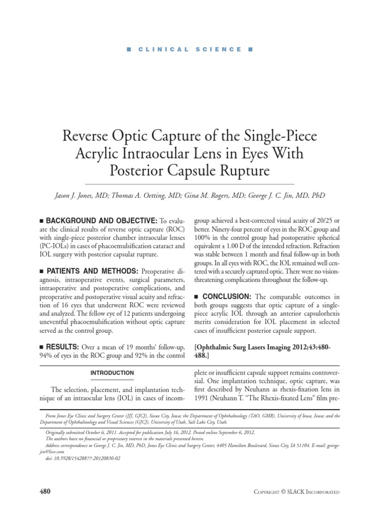 Reverse Optic Capture of The Single | PDF | Eye | Face