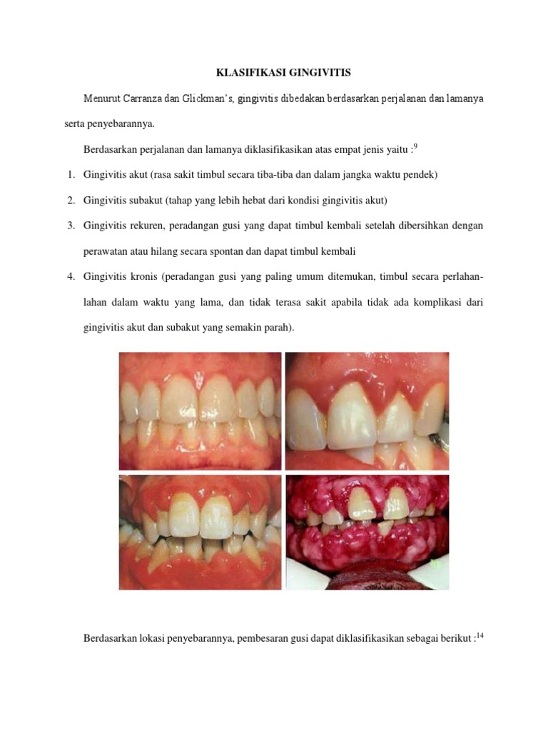 Klasifikasi Gingivitis | PDF