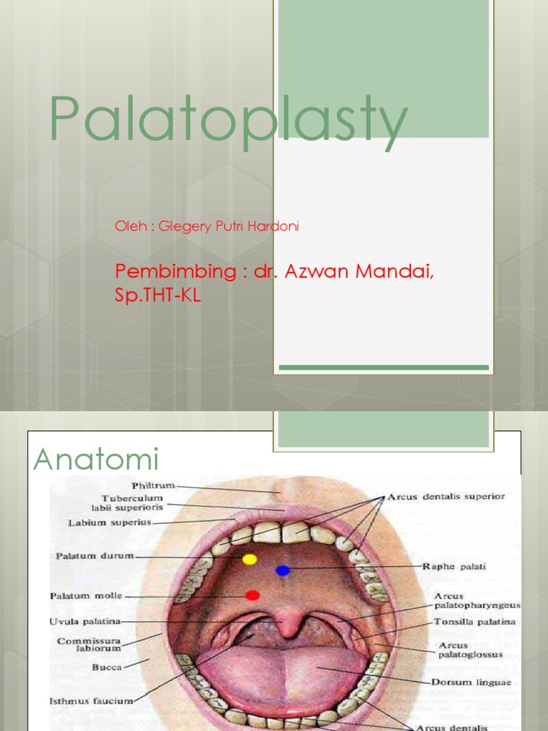 Palatoplasty | PDF