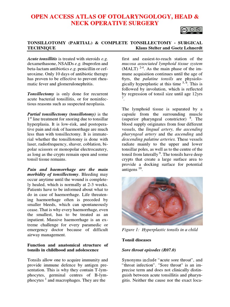 Tonsillotomy - Partial - and Complete Tonsillectomy Surgical Technique ...