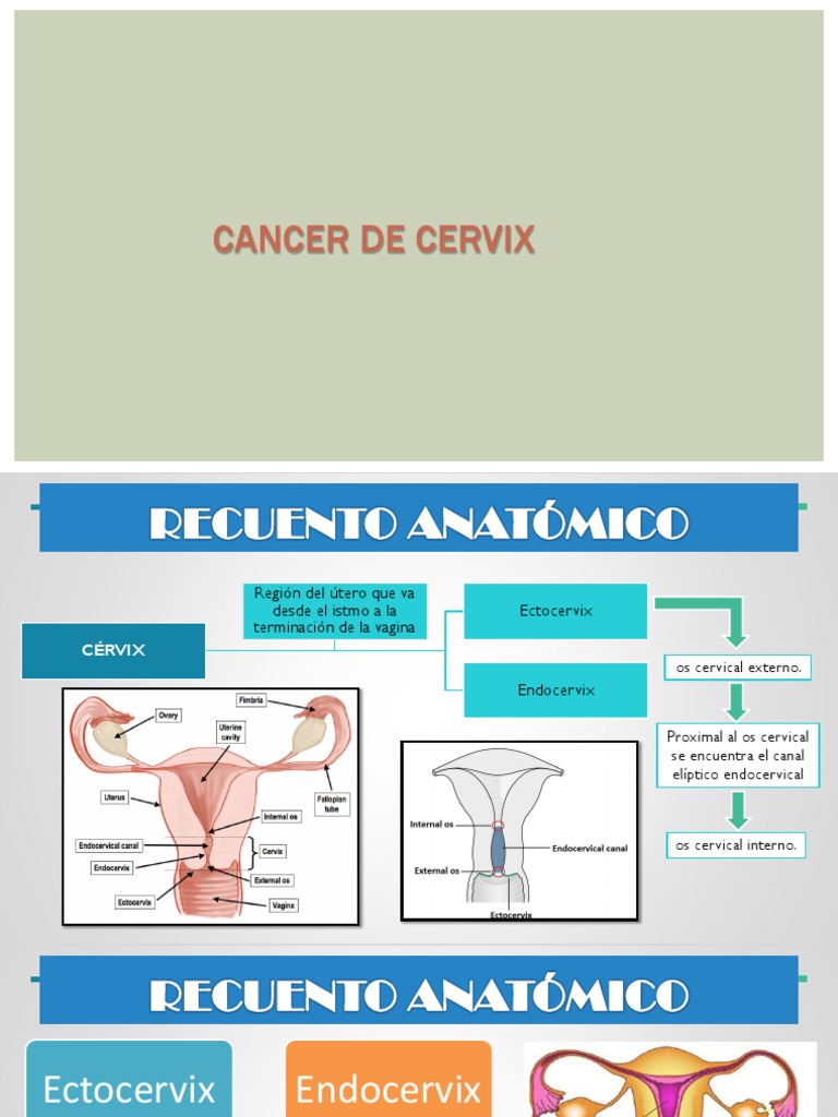 Cancer Cervix | Cáncer de cuello uterino | Cáncer