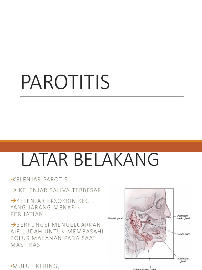 PAROTITIS | PDF