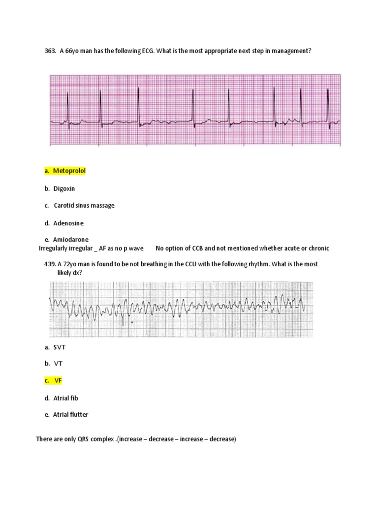 Ecg Mcqs 1700 DR - Afsana | PDF