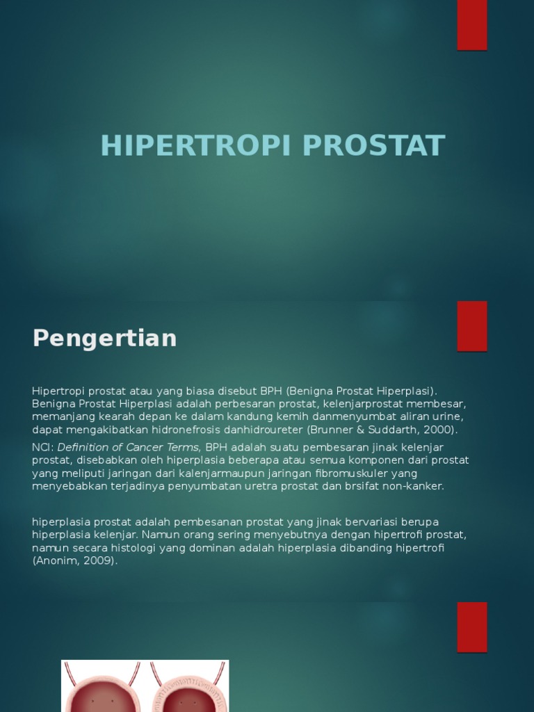 Hipertropi Prostat | PDF | Sains & Matematika