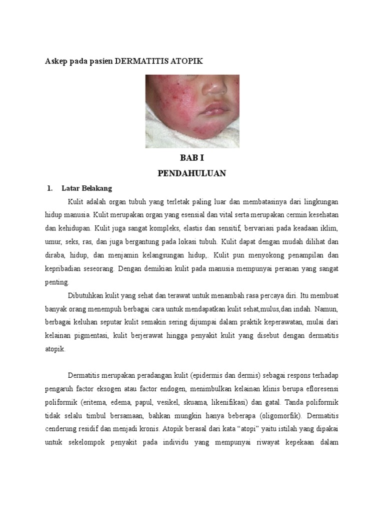 Askep Pada Pasien Dermatitis Atopik | PDF