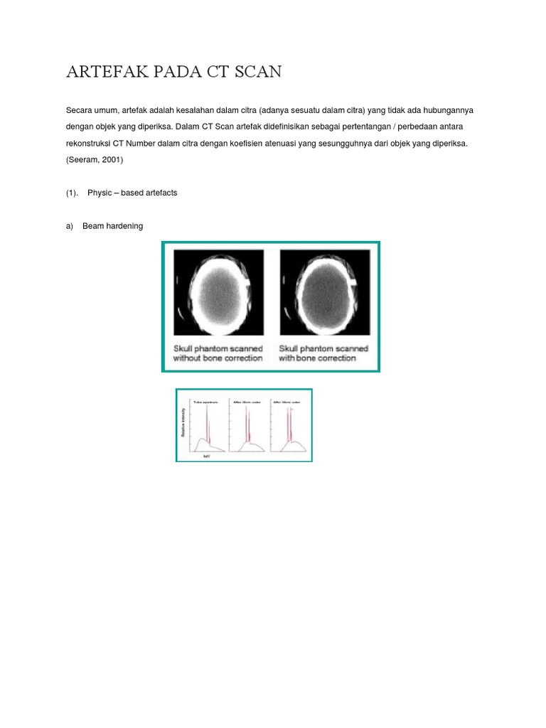 Artefak Pada CT Scan | PDF