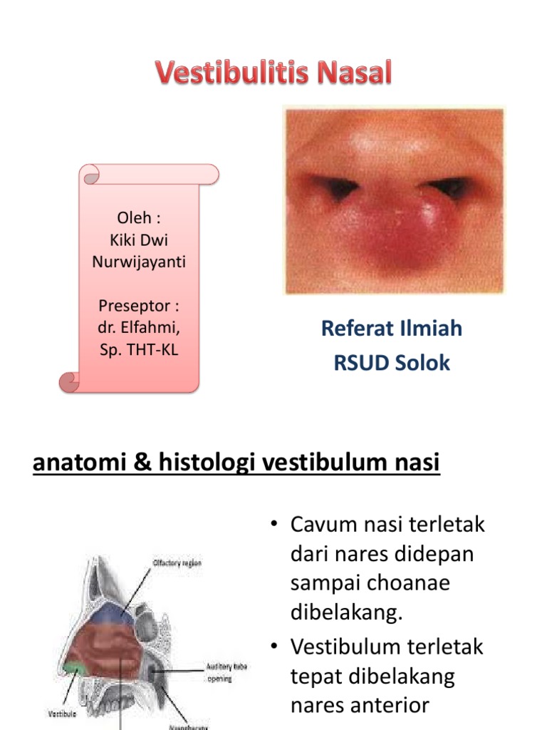 Penanganan Vestibulitis Nasal | PDF
