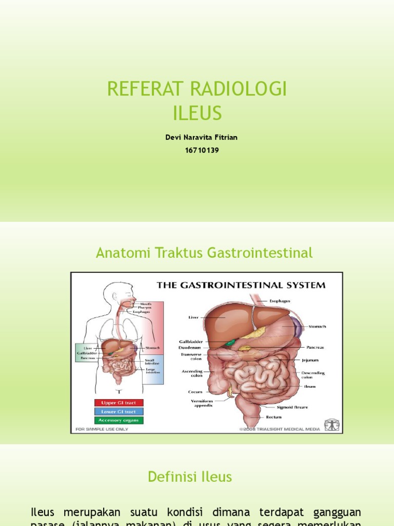 Ileus: Jenis, Gejala, dan Diagnosis | PDF