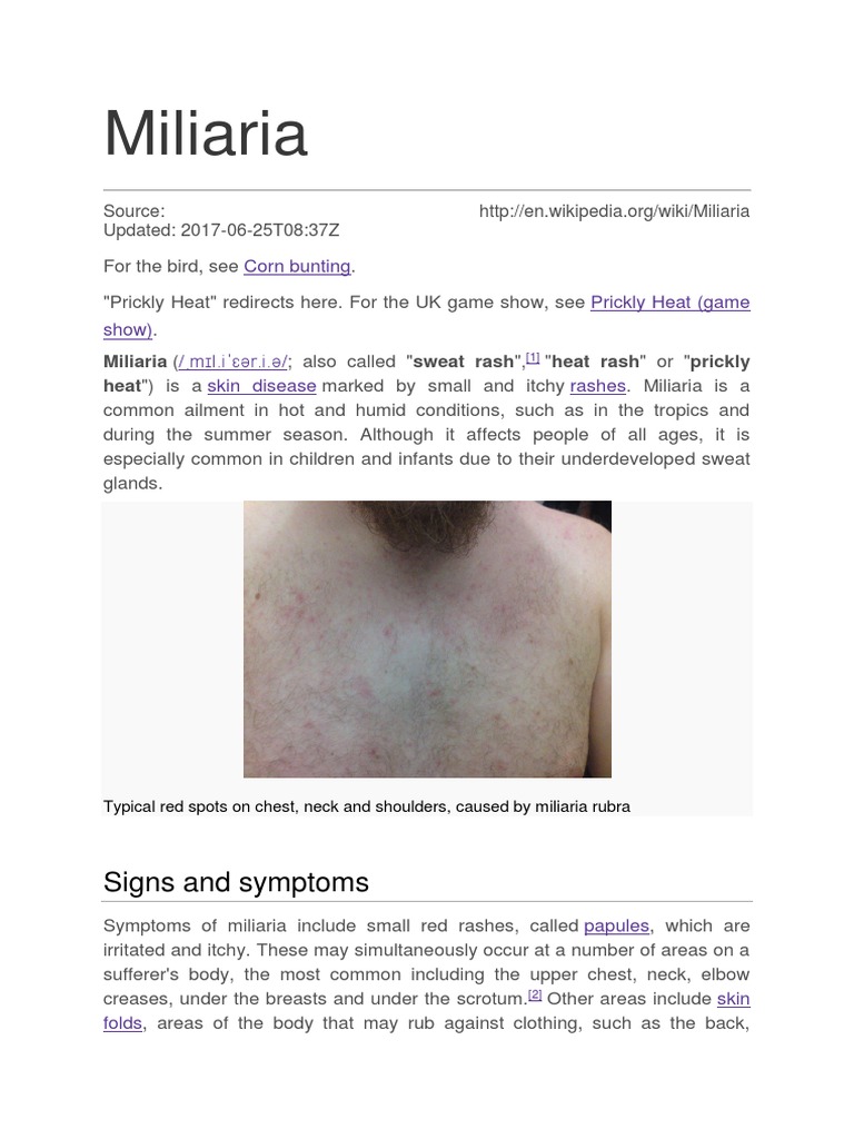 Miliaria | PDF | Dermatology | Medical Specialties