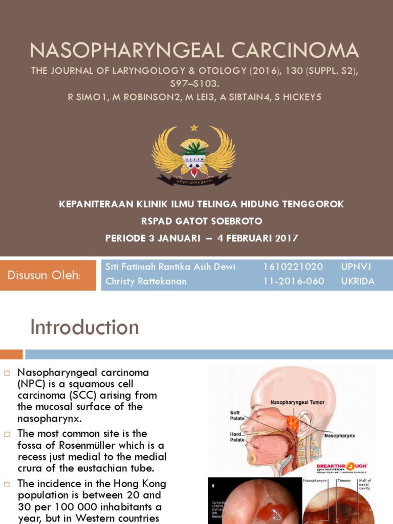 Nasopharyngeal Carcinoma Overview | PDF | Human Anatomy | Medical ...