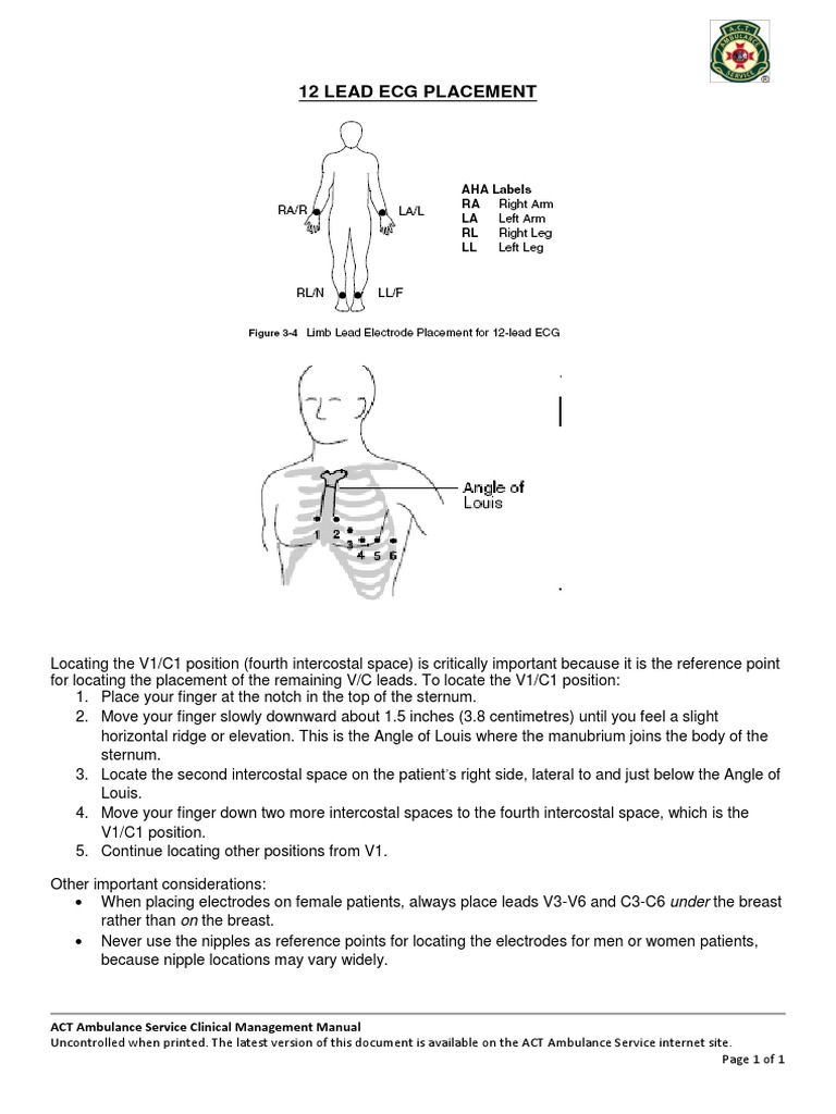 12 Lead ECG Placement | PDF