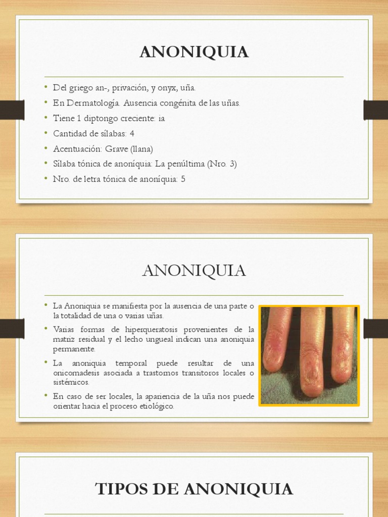 Anoniquia: Tipos, Causas y Tratamiento | PDF | Clavo (anatomía) | Hueso