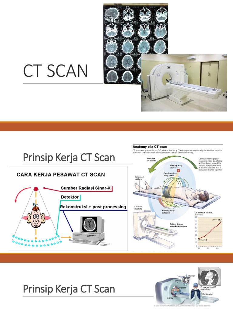 CT Scan | PDF