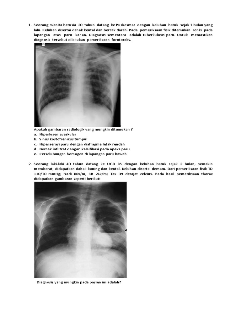 Contoh Radiologi | PDF