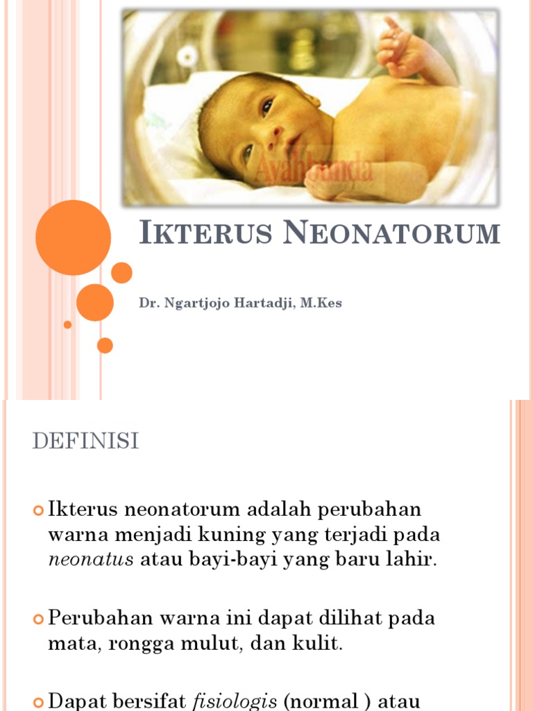Ikterus Neonatorum | PDF