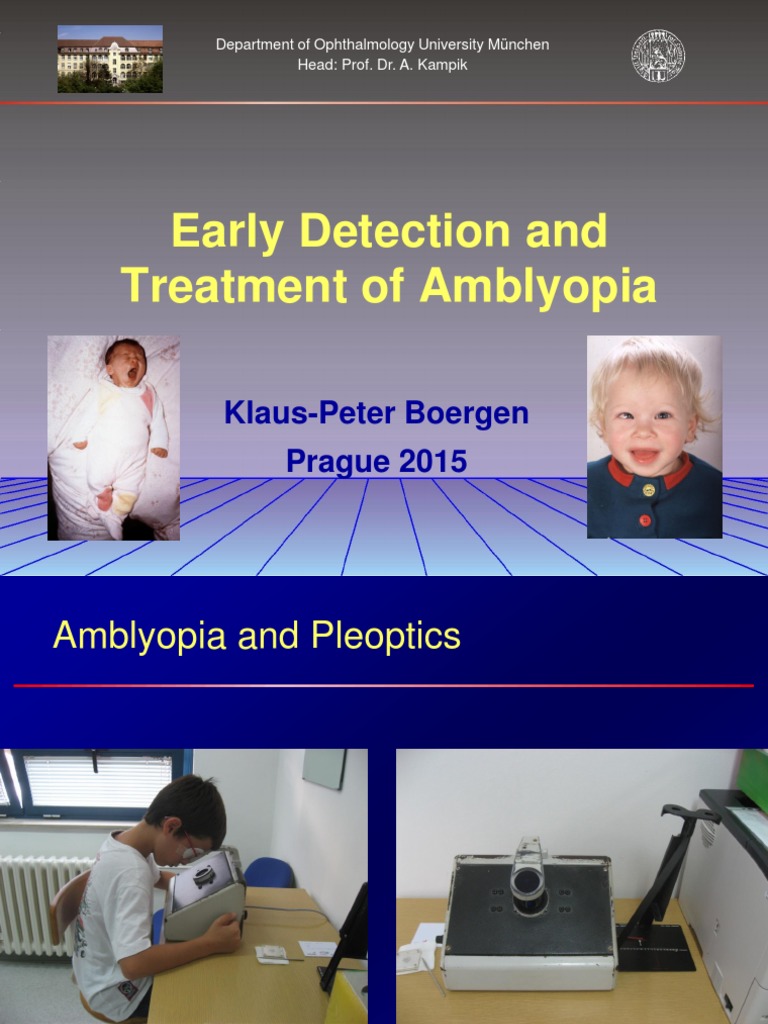 Early Detection and Treatment of Amblyopia | PDF | Visual Acuity | Contrast (Vision)