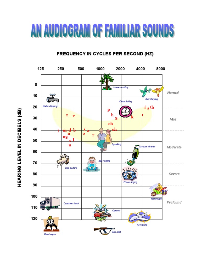 Audiogram Chart | PDF | Neurology | Otorhinolaryngology