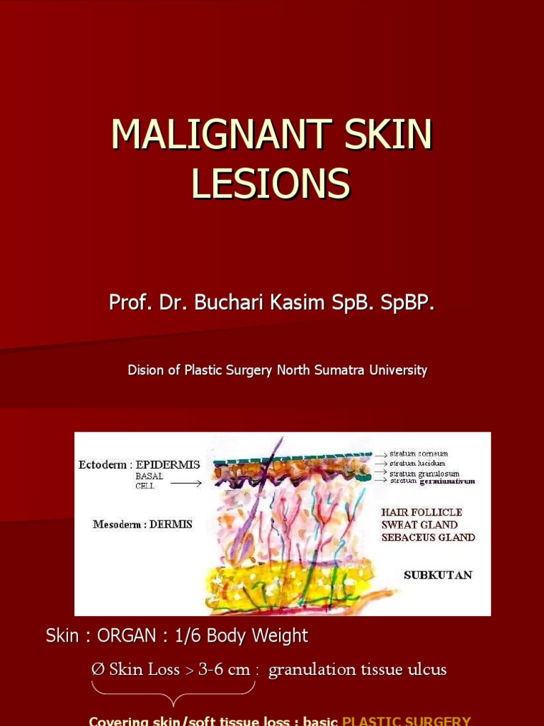 Malignant Skin Lesions | PDF | Metastasis | Melanoma