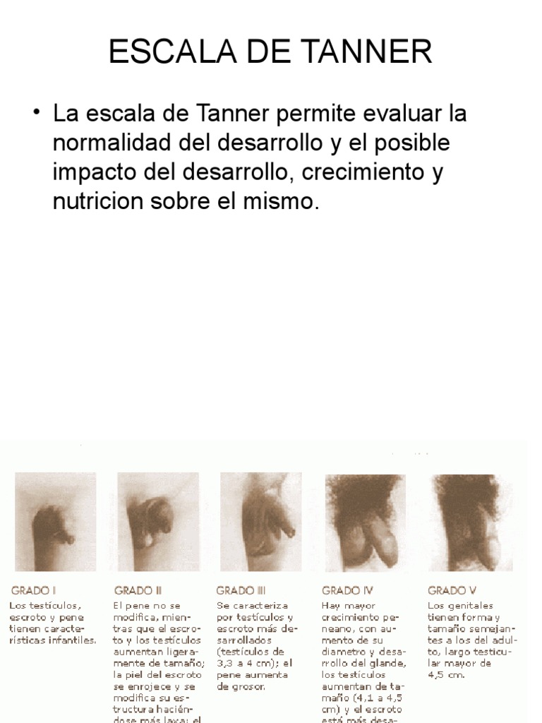 Escala de Tanner 22 | PDF