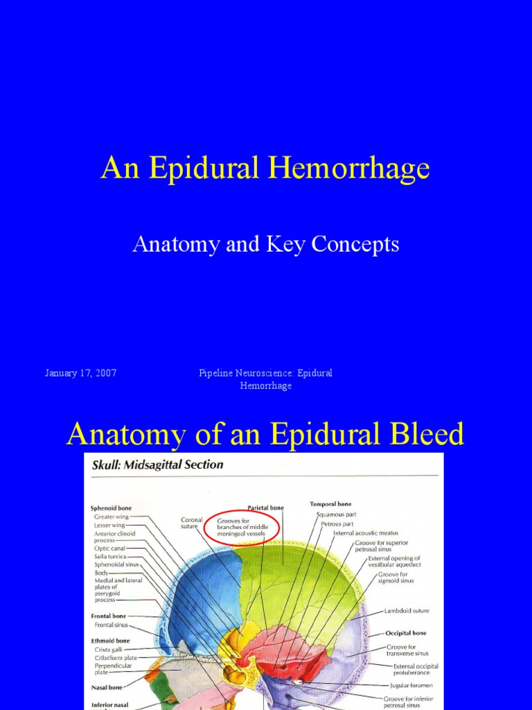 An Epidural Hemorrhage: Anatomy and Key Concepts | PDF | Neuroanatomy ...