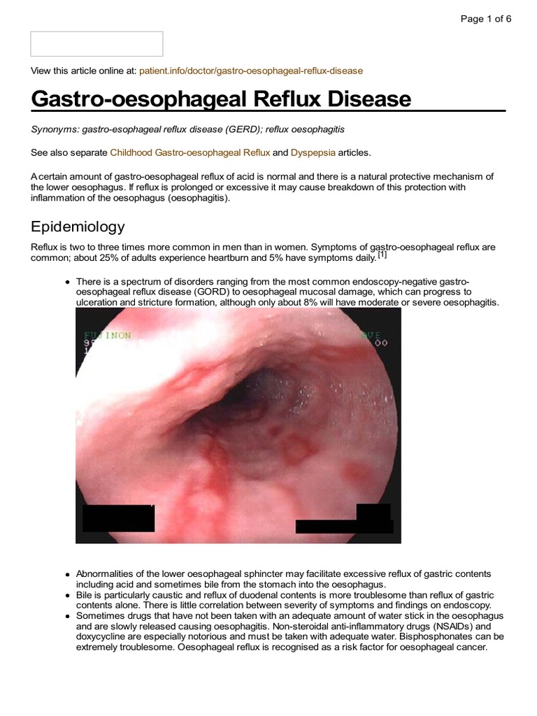 Gastro-Oesophageal Reflux Disease: Epidemiology | PDF | Gastroesophageal Reflux Disease ...