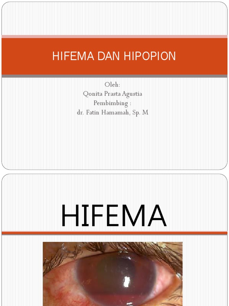 Hifema Hipopion | PDF