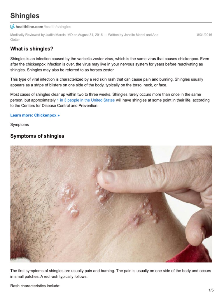 Shingles | PDF | Microbiology | Rtt