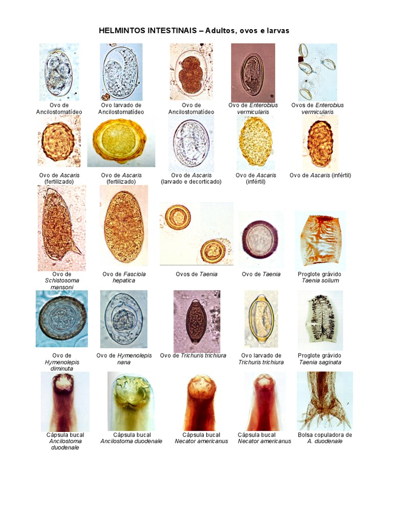 Representación visual de los diferentes tipos de helmintos intestinales ...