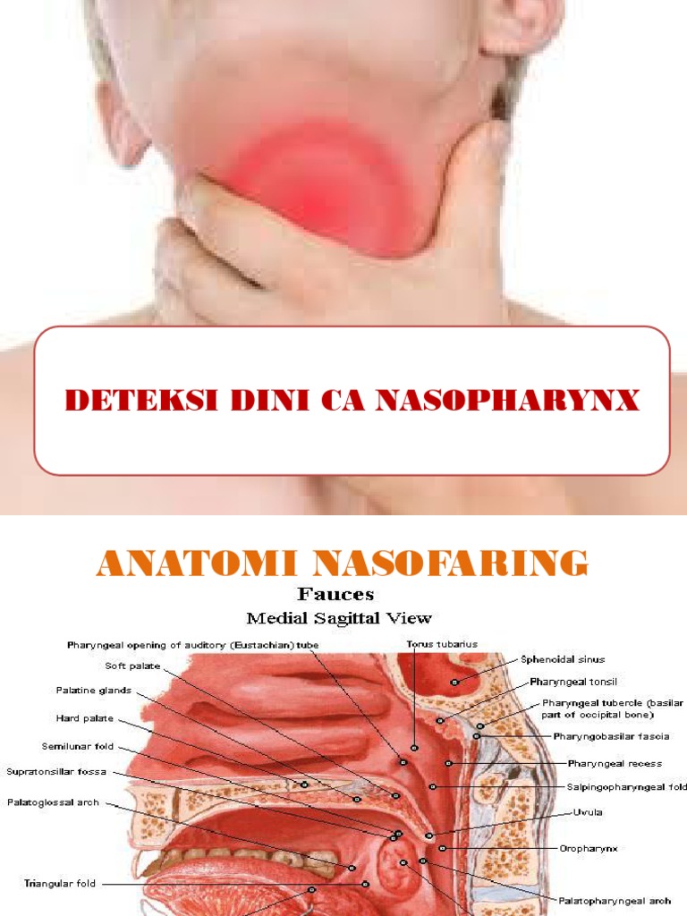 Deteksi Dini Kanker Nasofaring | PDF