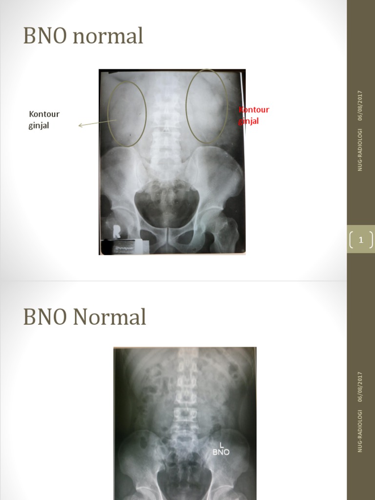 NUG-Radiologi NUG | PDF