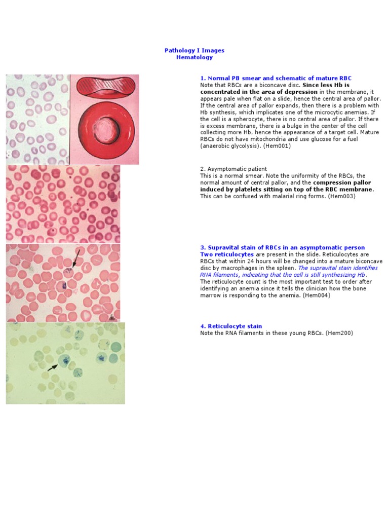 Hematology Pathology Slide Overview | PDF | Anemia | White Blood Cell