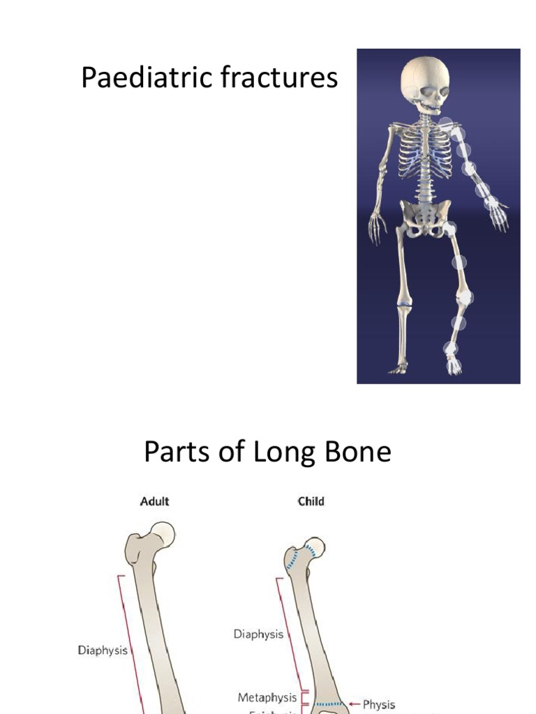 Pediatric Fractures: Types and Management | PDF | Elbow | Bone
