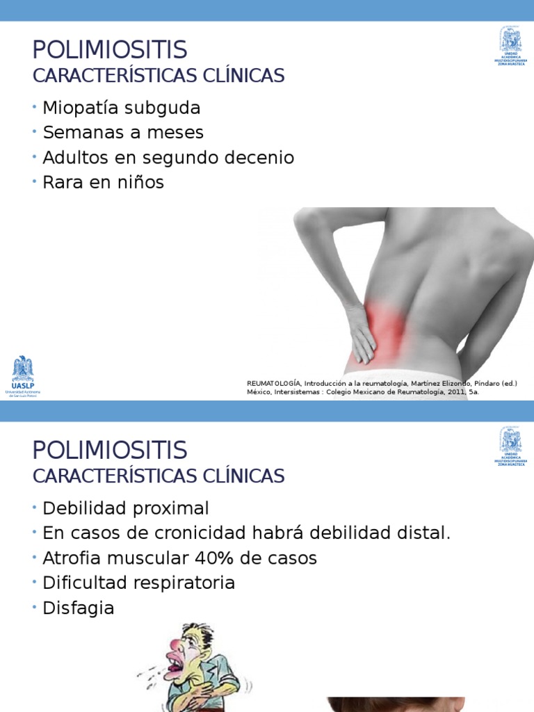 Características Clínicas de La Polimiositis | PDF | Inmunología ...